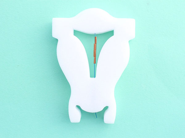 GyneFix; hormonsuz rahim içi araç | Op. Dr. Uzay Yıldırım